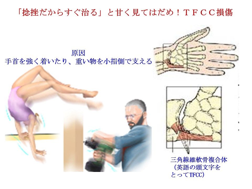 %e6%89%8b%e9%a6%96%e3%81%ae%e5%b0%8f%e6%8c%87%e5%81%b4%e3%81%8c%e7%97 ...